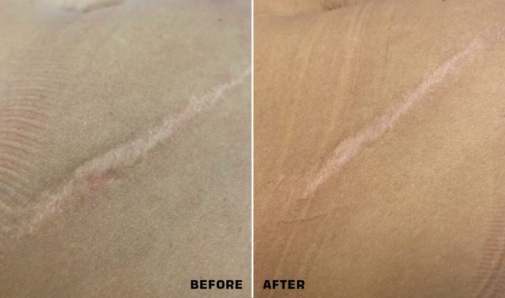 Gallery | Bimini Body Contouring